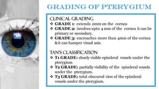 Pterygium (Arma) | PDF