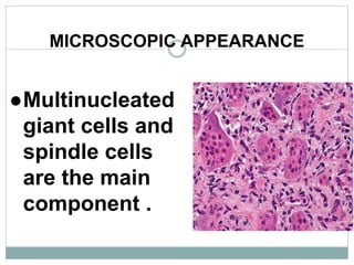 Giant Cell Tumour | PPTX