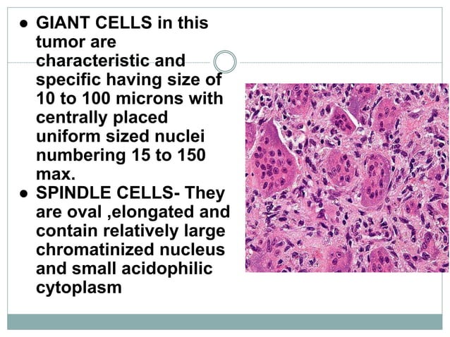Giant Cell Tumour | PPTX