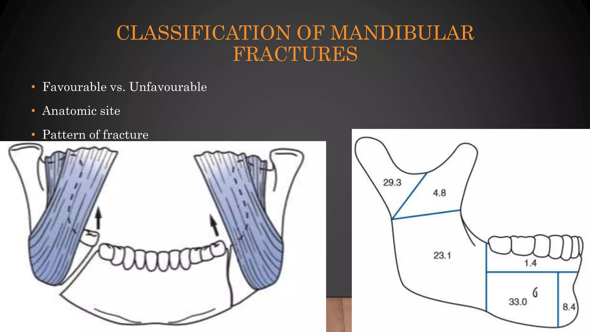 Mandibular and Maxillary Fractures | PPTX