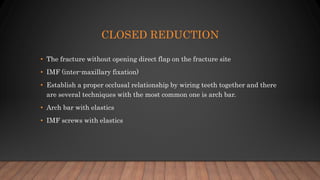 Mandibular and Maxillary Fractures | PPTX