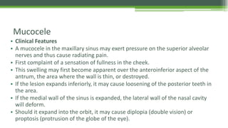 Radiographic Features of Paranasal Sinuses | PPTX