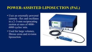 Liposuction | PPTX