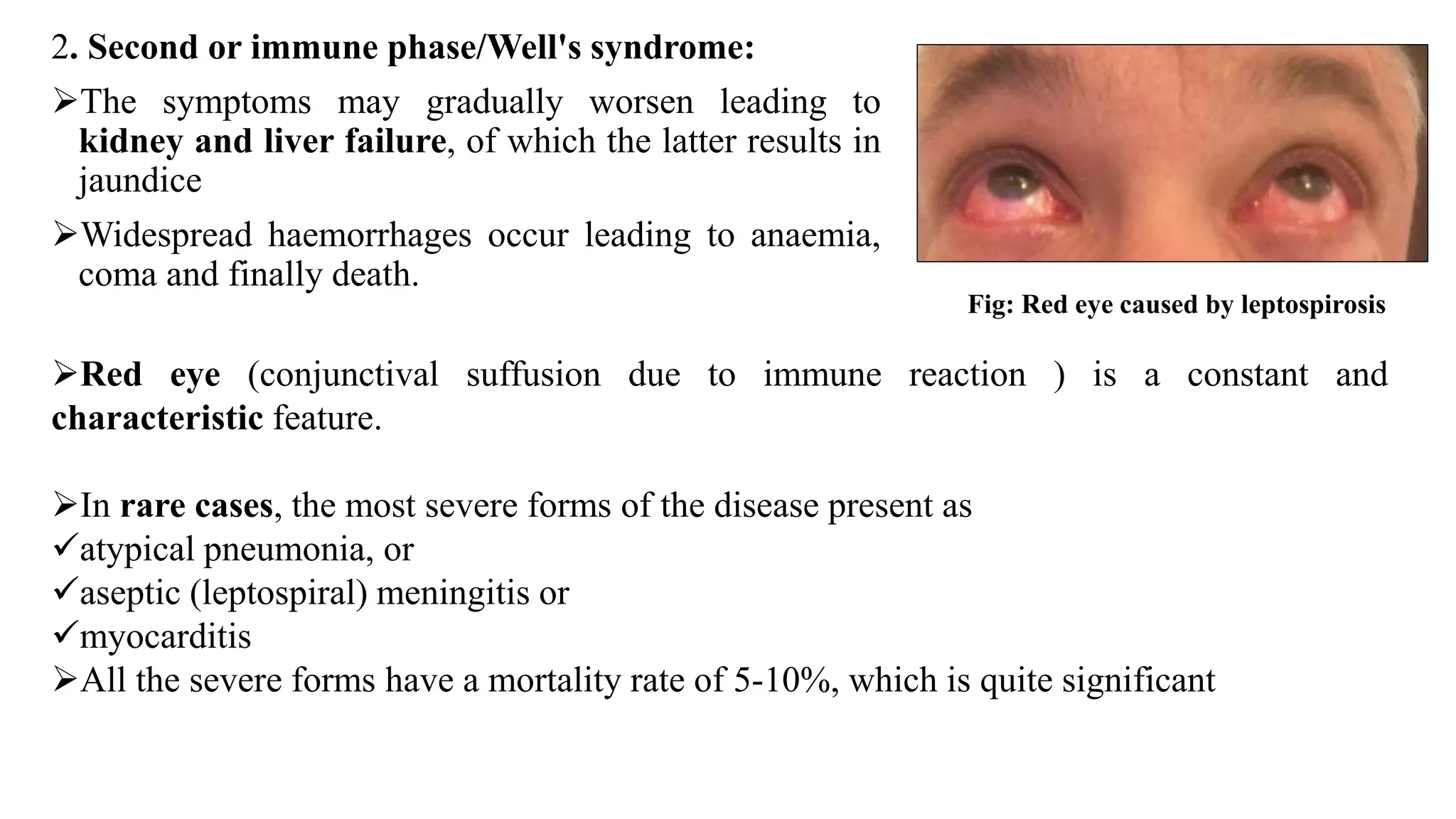 Leptospirosis: Its Epidemiology, Diagnosis and Control | PPTX