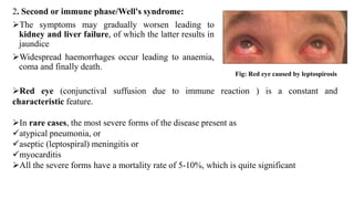 Leptospirosis: Its Epidemiology, Diagnosis and Control | PPTX