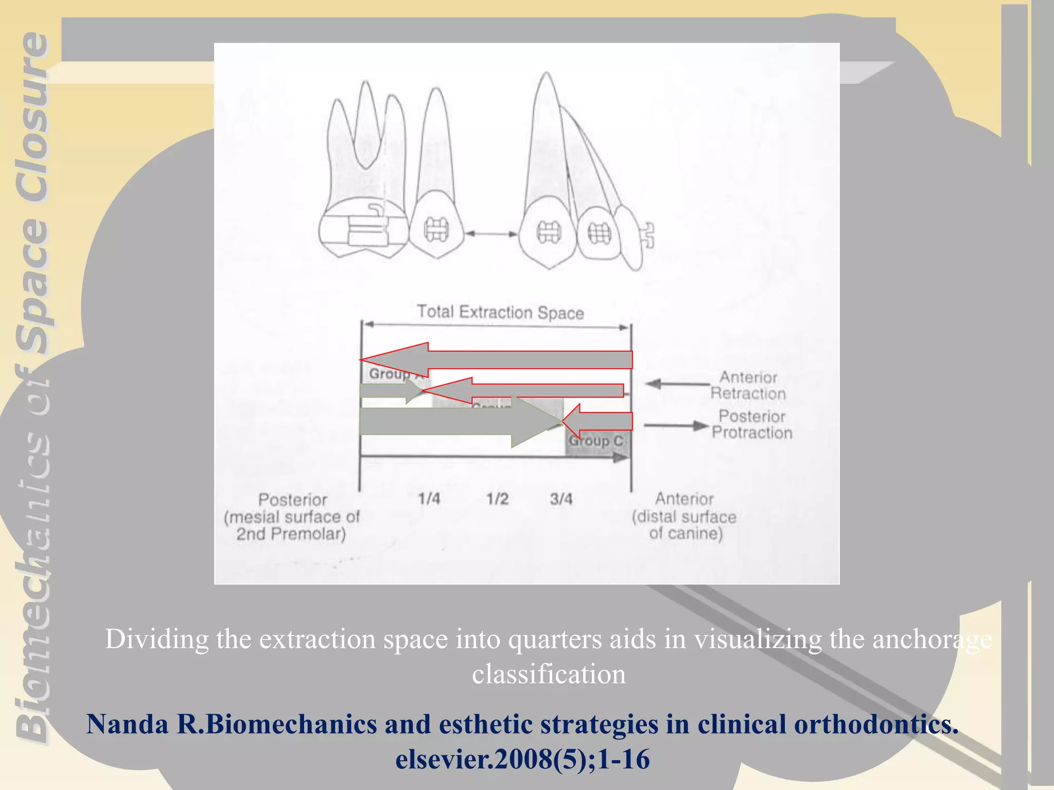 Biomechanics of Space Closure | PPT