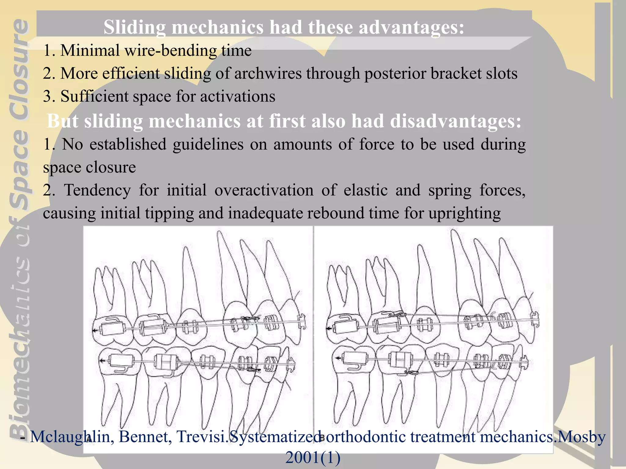 Biomechanics of Space Closure | PPT