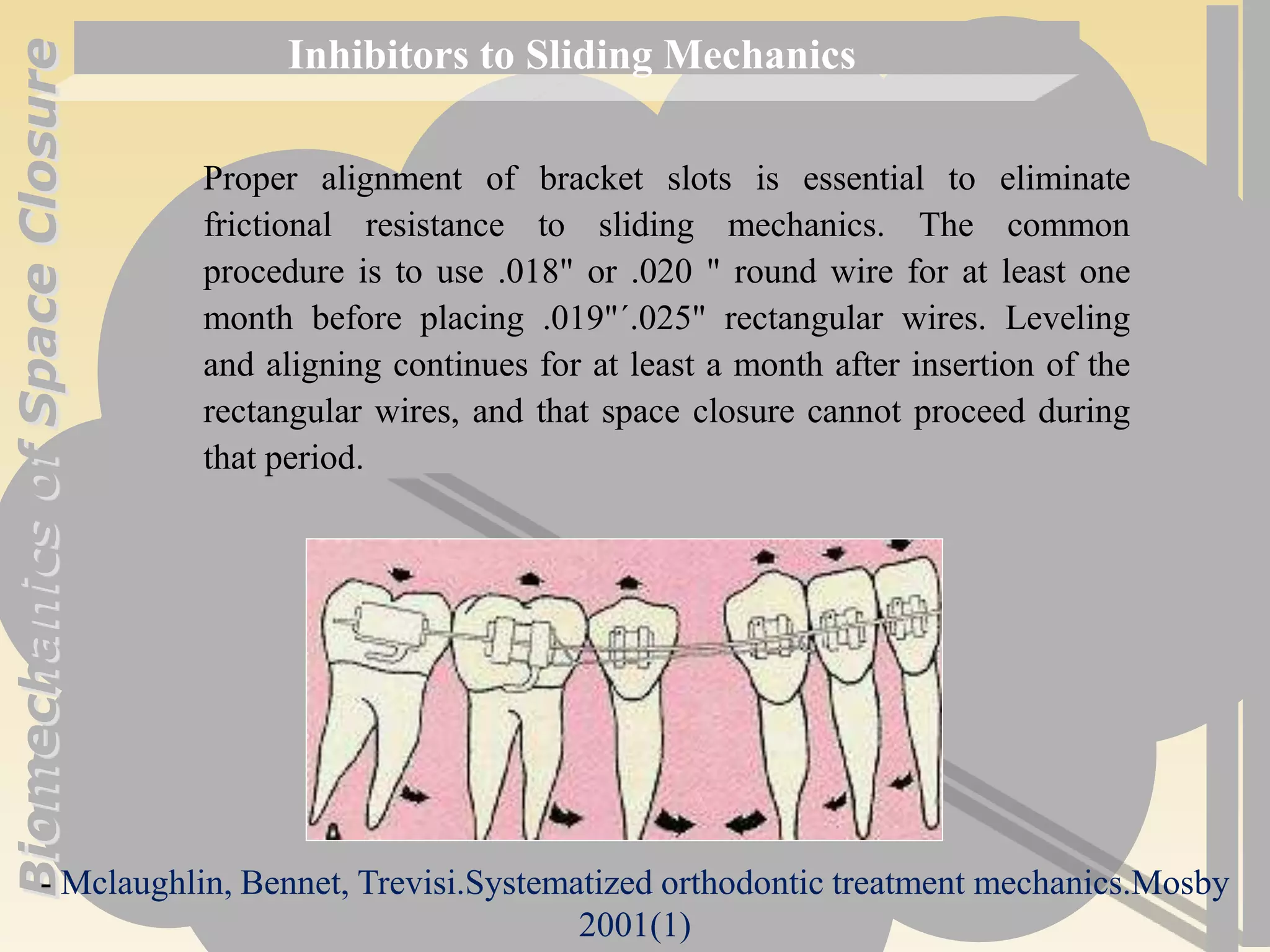 Biomechanics of Space Closure | PPT