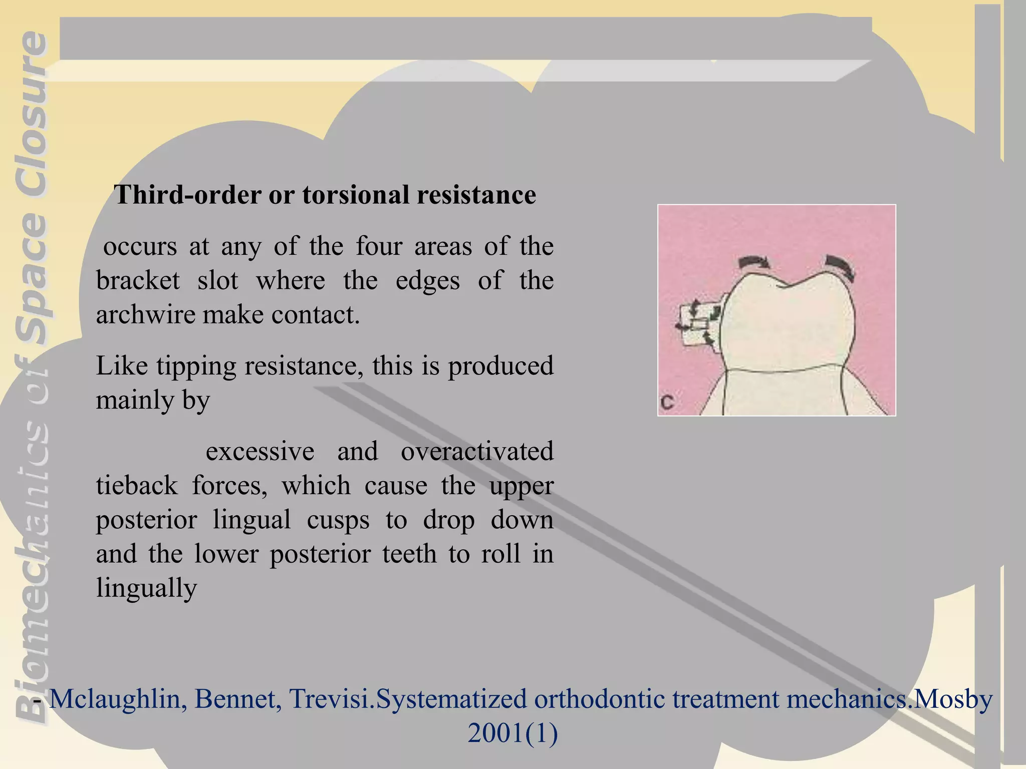 Biomechanics of Space Closure | PPT
