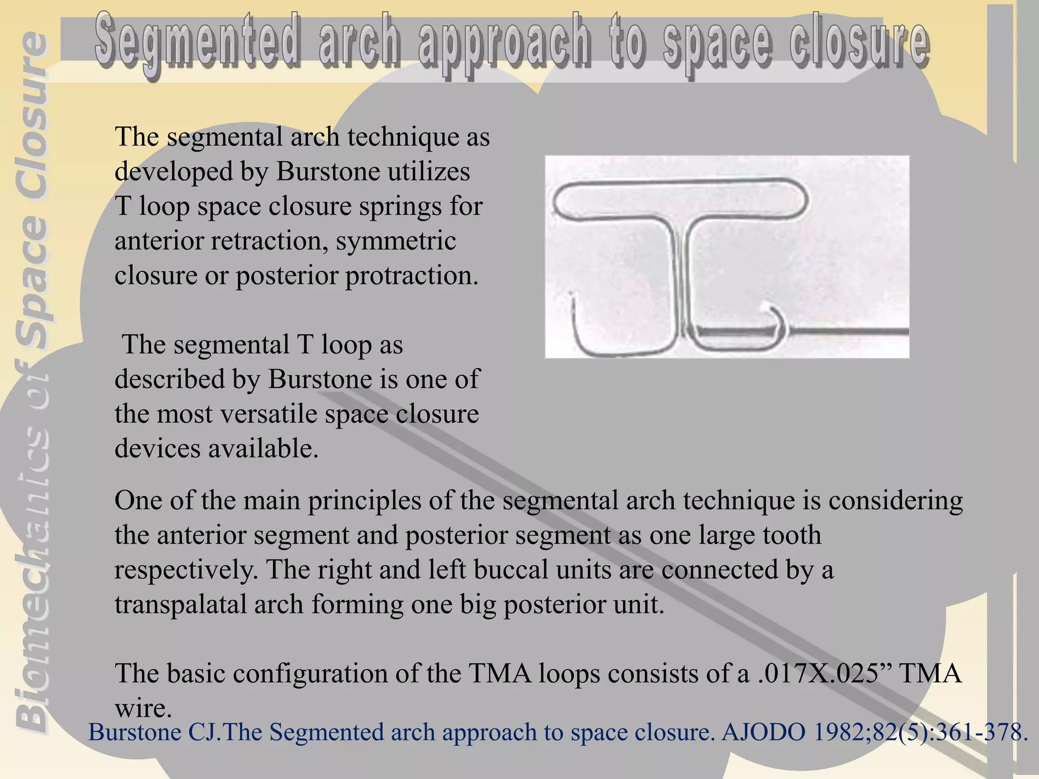 Biomechanics of Space Closure | PPT