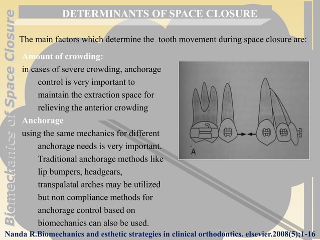 Biomechanics of Space Closure | PPT
