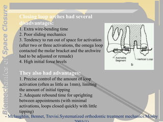 Biomechanics of Space Closure | PPT