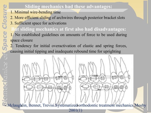 Biomechanics of Space Closure | PPT