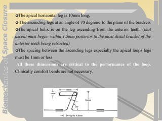 Biomechanics of Space Closure | PPT