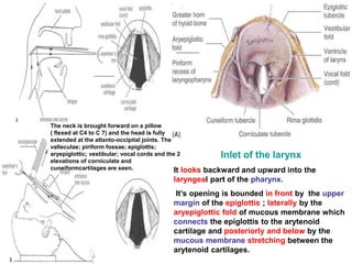 23. larynx.ppt about anatomy of larynx . | PPT