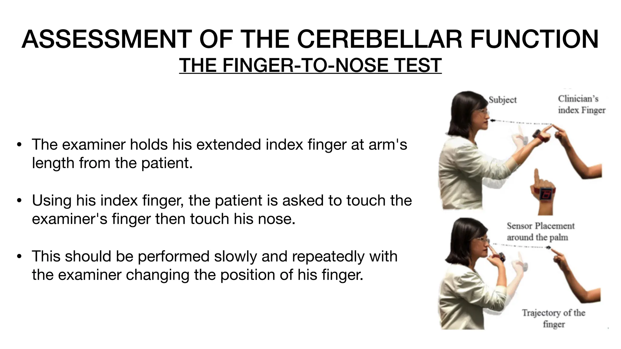 Assessment of the Cerebellar Function.pdf