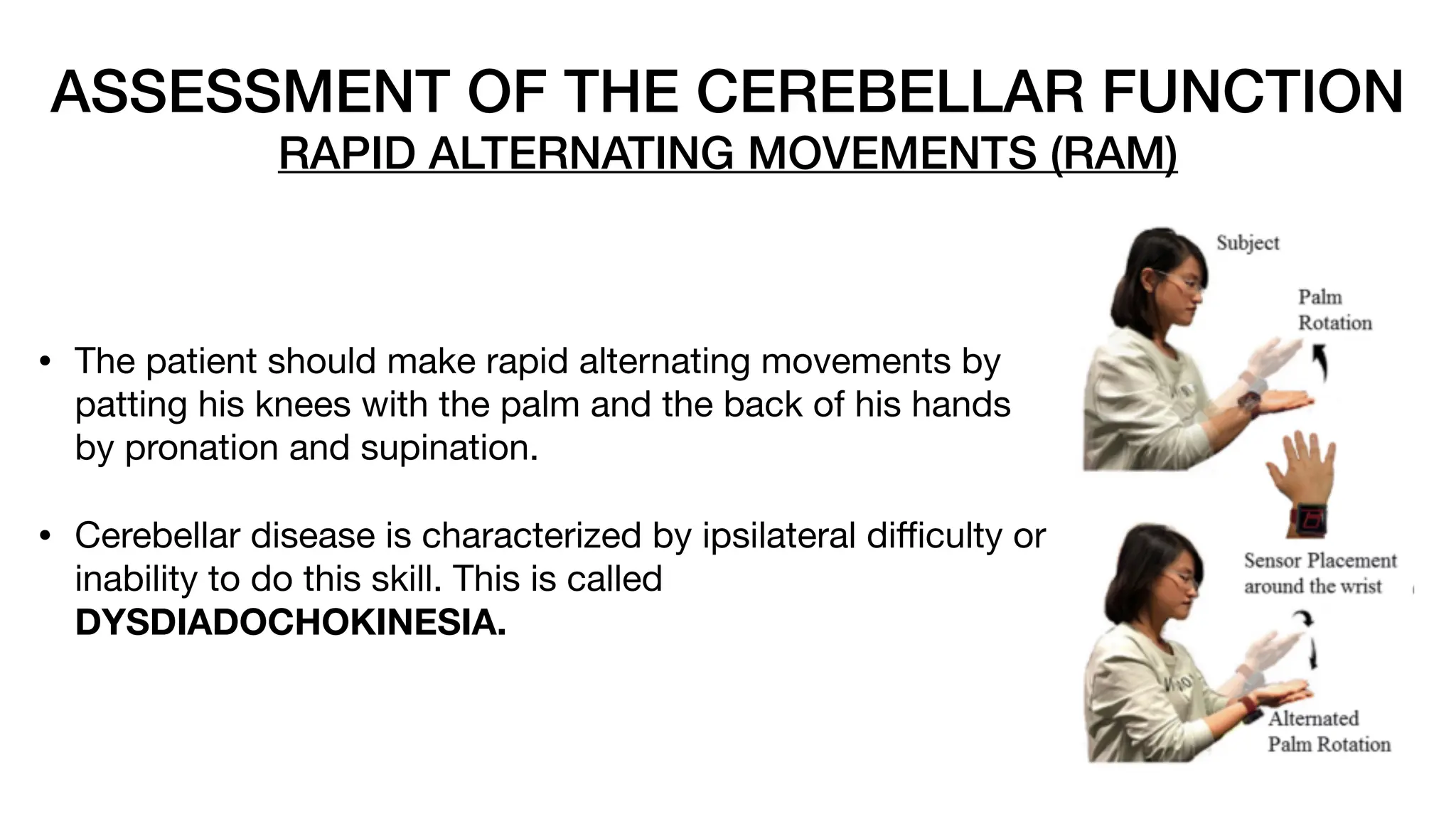 Assessment of the Cerebellar Function.pdf