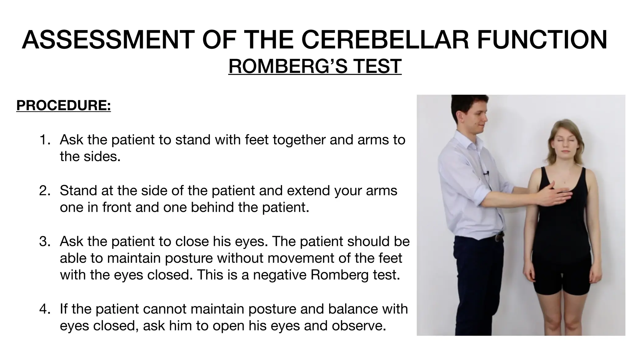 Assessment of the Cerebellar Function.pdf