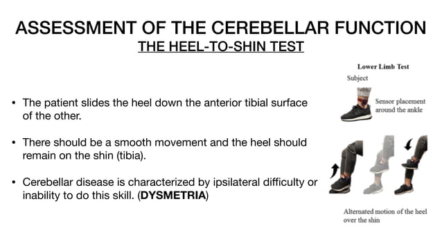 Assessment of the Cerebellar Function.pdf | Foot Health | Diseases and ...