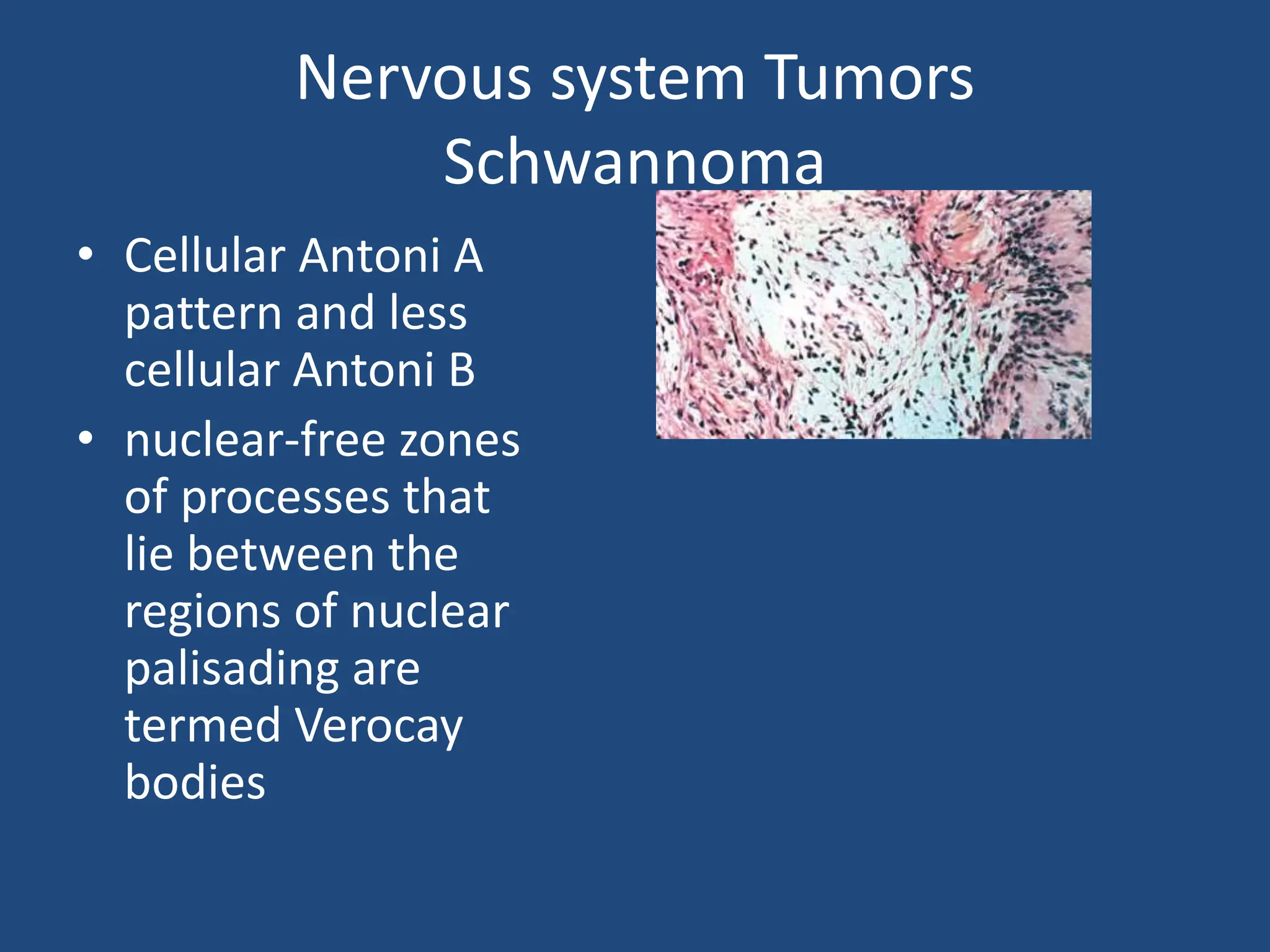 2,3-CNSTumors.ppt Central nervous system | PPT