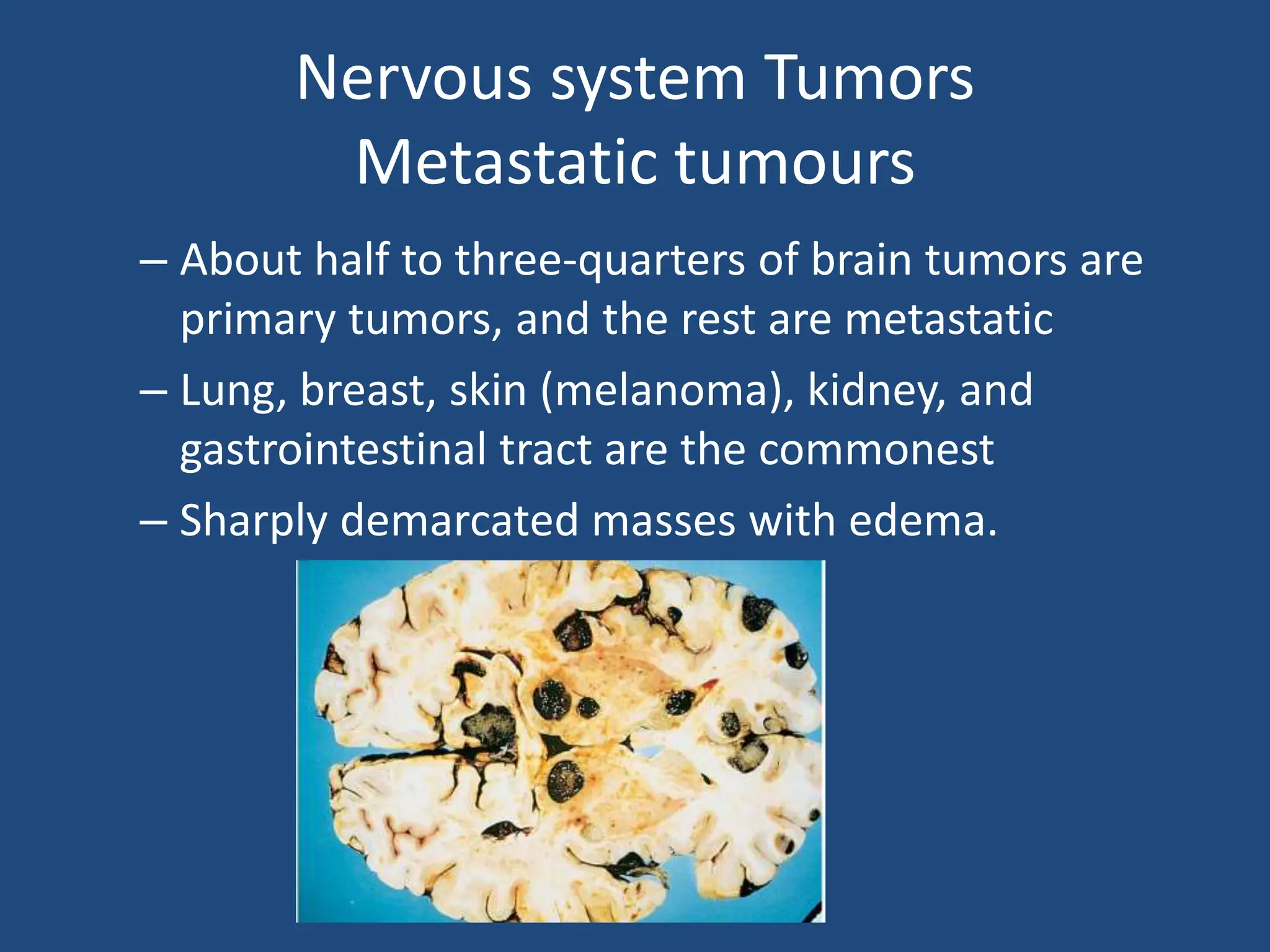 2,3-CNSTumors.ppt Central nervous system | PPT