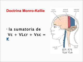 La Doctrina De Monro Kellie