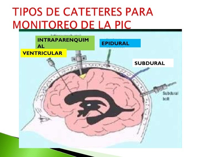 23. cuidado enfermero al paciente con monitorizacion de pic lobitofer…