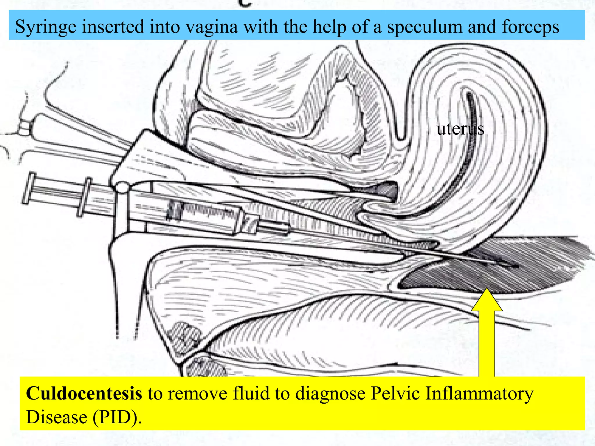 23 female-reproductive-system-1213116557688874-8-1 | PPT
