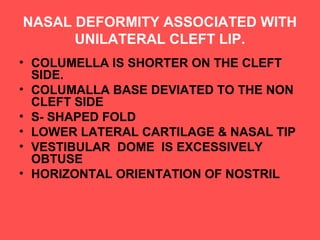 23 introduction cleft lip & palate | PPT