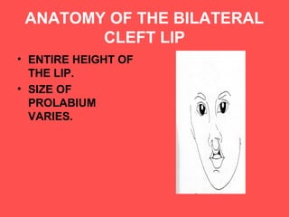 23 introduction cleft lip & palate | PPT