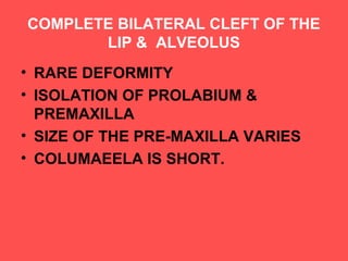 23 introduction cleft lip & palate | PPT