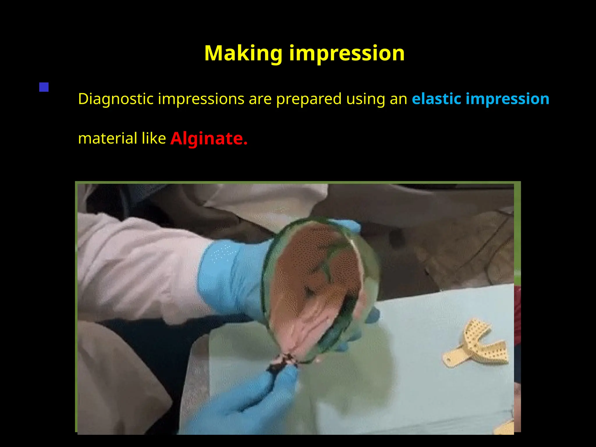 Primary impression and Primary cast.pptx