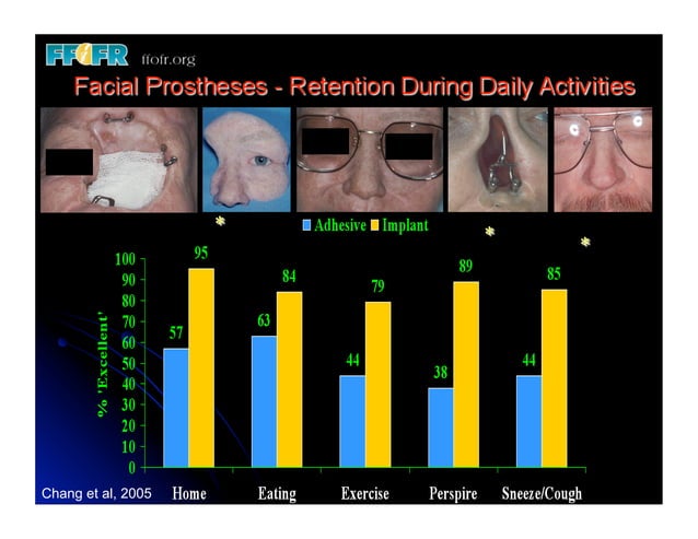 23.restoration of nasal defects | PDF
