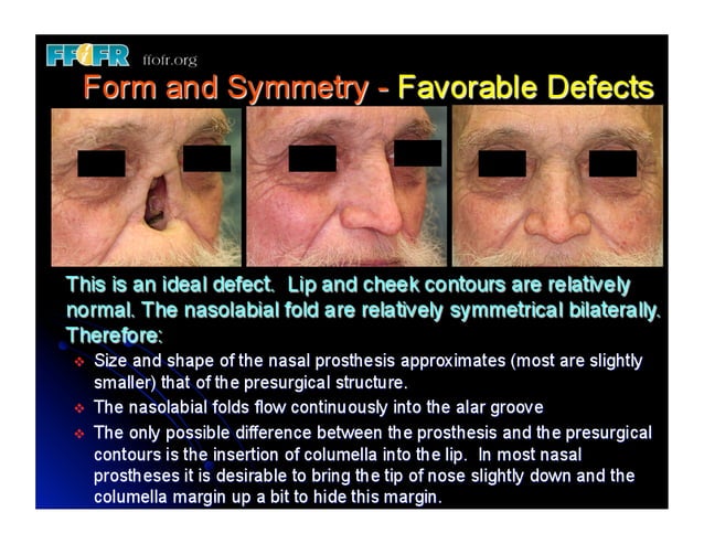 23.restoration of nasal defects | PDF