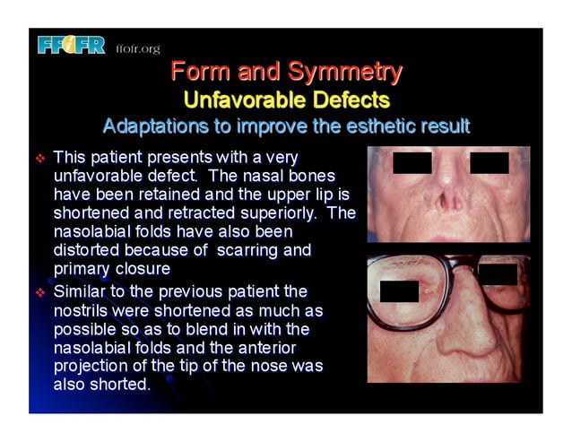 23.restoration of nasal defects | PDF