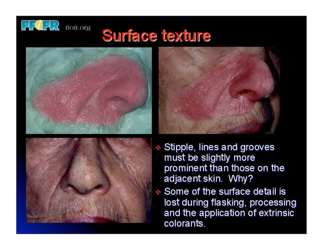 23.restoration of nasal defects | PDF