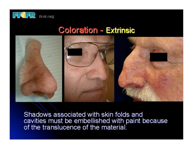 23.restoration of nasal defects | PDF