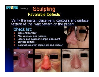 23.restoration of nasal defects | PDF