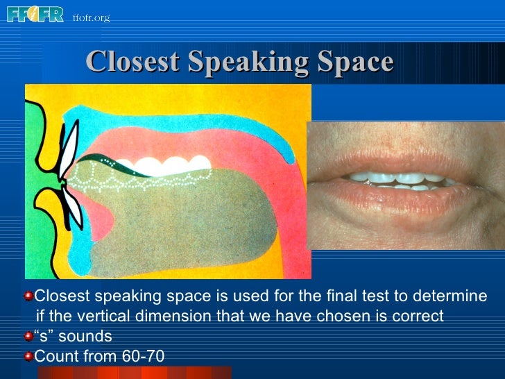 23.trial denture appointment