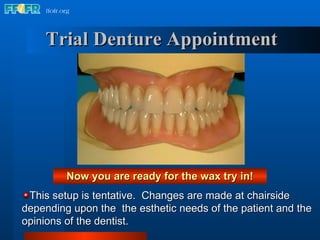 23.trial denture appointment | PPT
