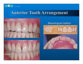 23.trial denture appointment | PPT