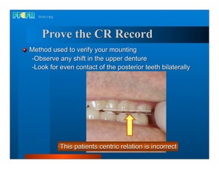 23.trial denture appointment | PDF