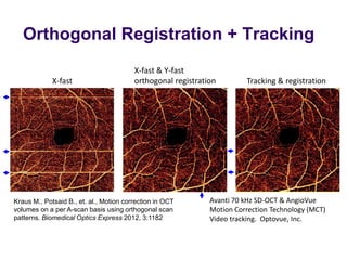 INNOVATION IN RETINAL IMAGING: OPPORTUNITIES & CHALLENGES - History of ...