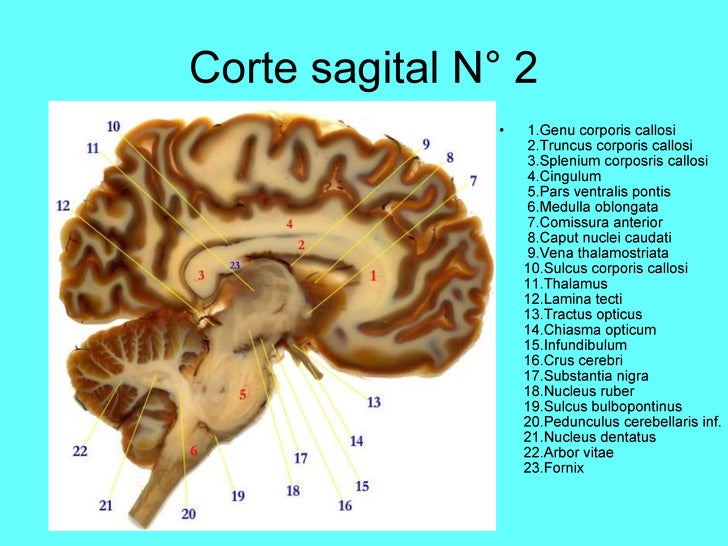 corte sagital de encefalo