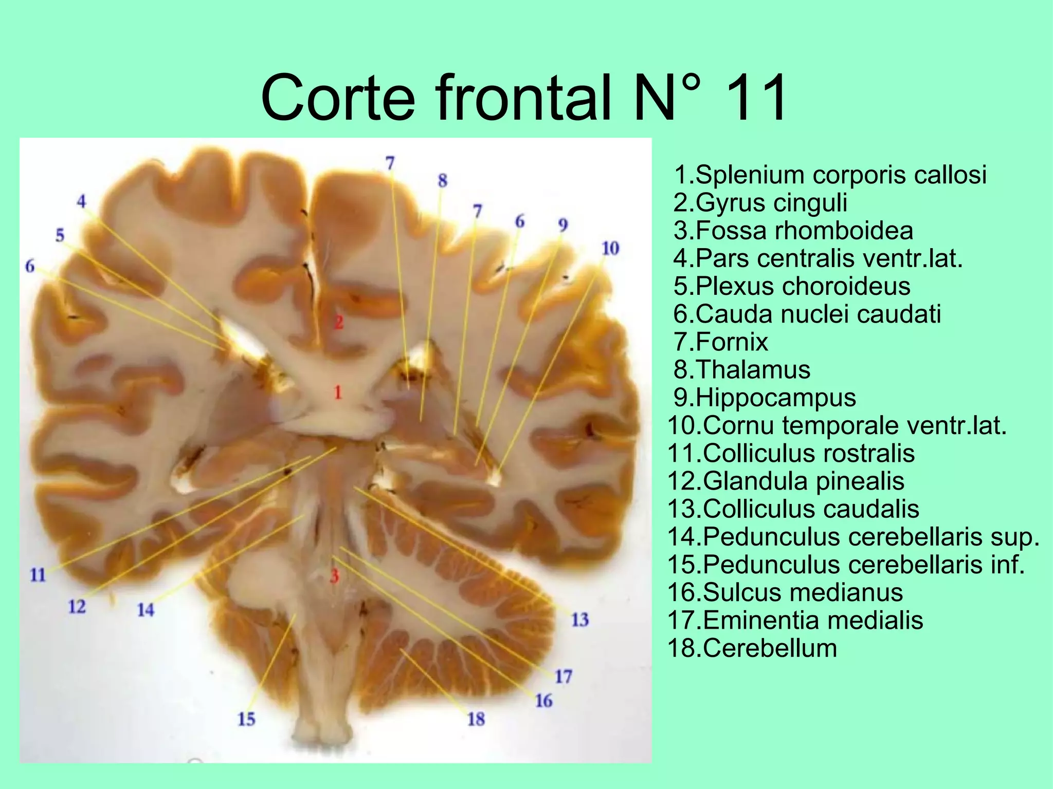 corte coronal de encefalo | PPT