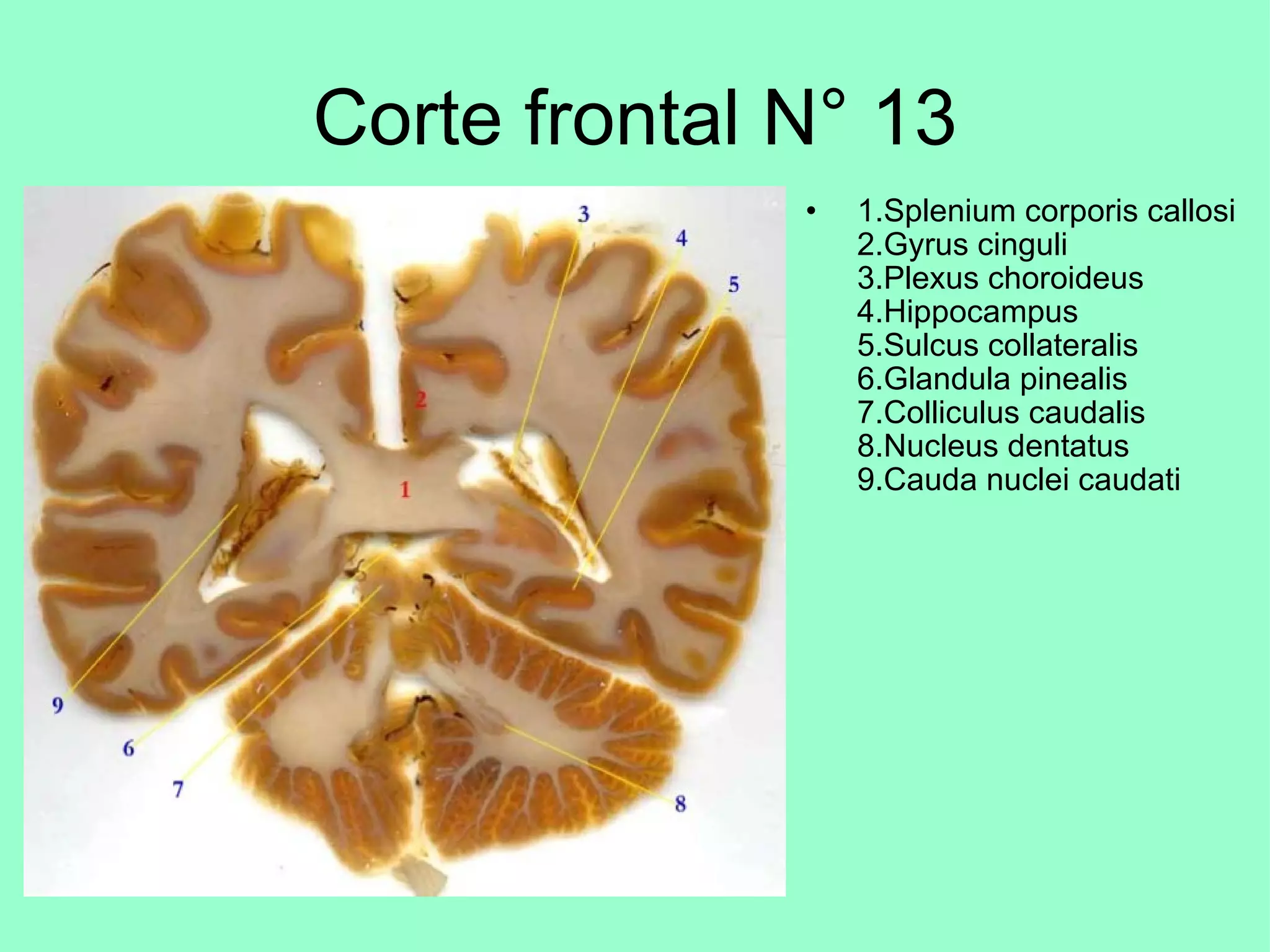 corte coronal de encefalo | PPT