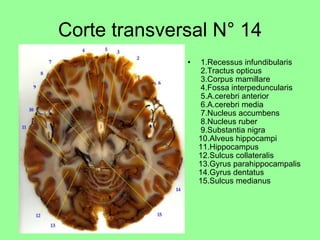 corte transversal de encefalo | PPT