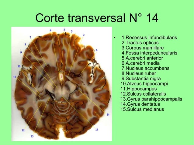 corte transversal de encefalo | PPT | Brain and Nervous System ...