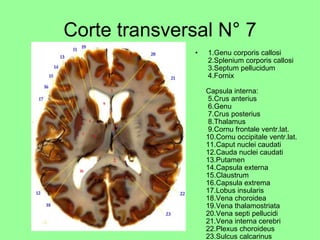 corte transversal de encefalo | PPT