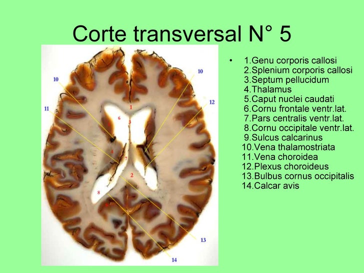 corte transversal de encefalo